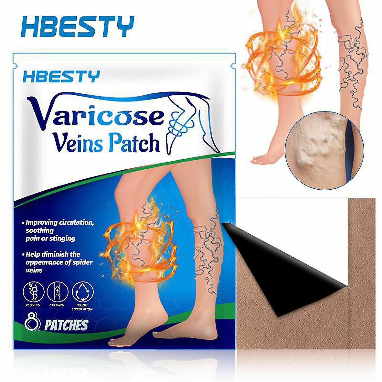 Varicose Veins Patch,spider Vein Legs Spider Vein Edema Neuralgia Leg ...