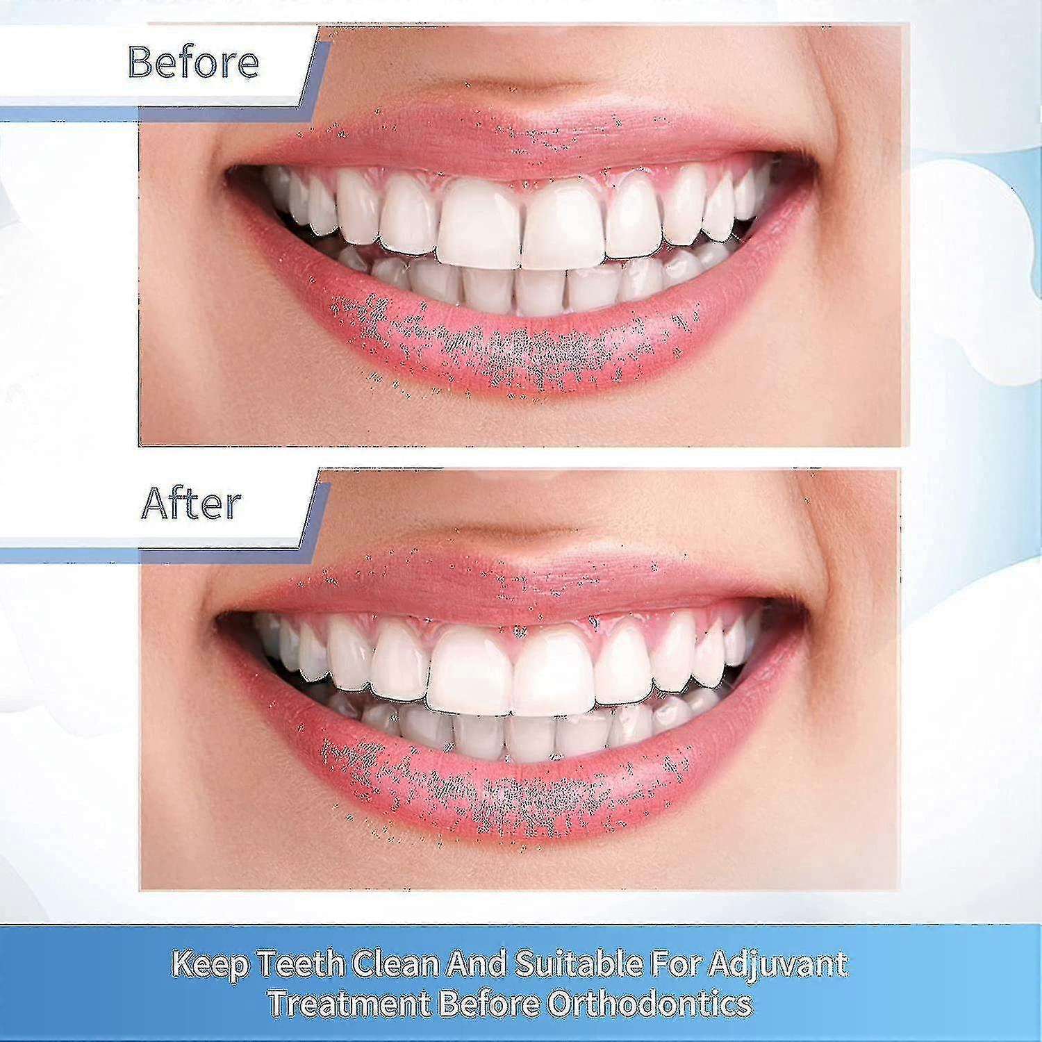 Dental Sandpaper,dental Polishing Strips,polishing Strips,dental ...