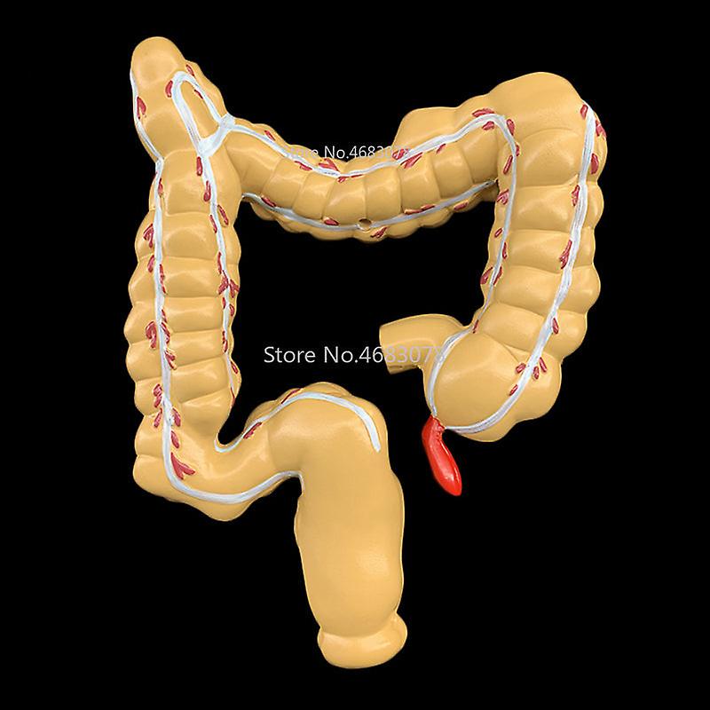 Colorectal Lesion Model Human Colon Large Intestine Pathological ...