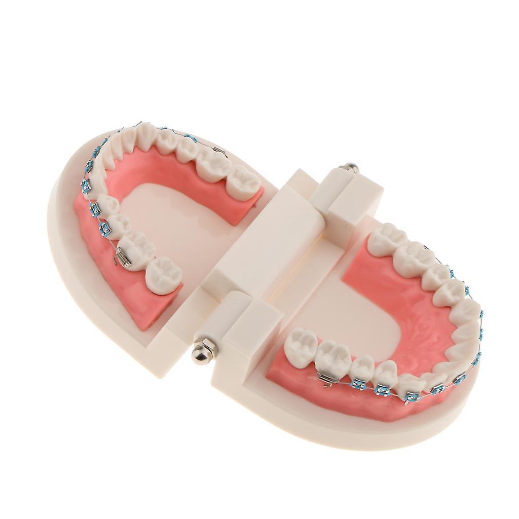 Dental Teach Study Orthodontic Tooth Teeth Model with Metal Brackets ...