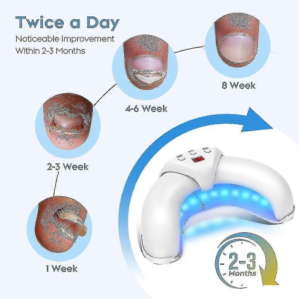 (Y)Nail Fungus Cleaning Laser Device for Multiple Toenail, Home Use 905nm Infrared Light + 470nm ...