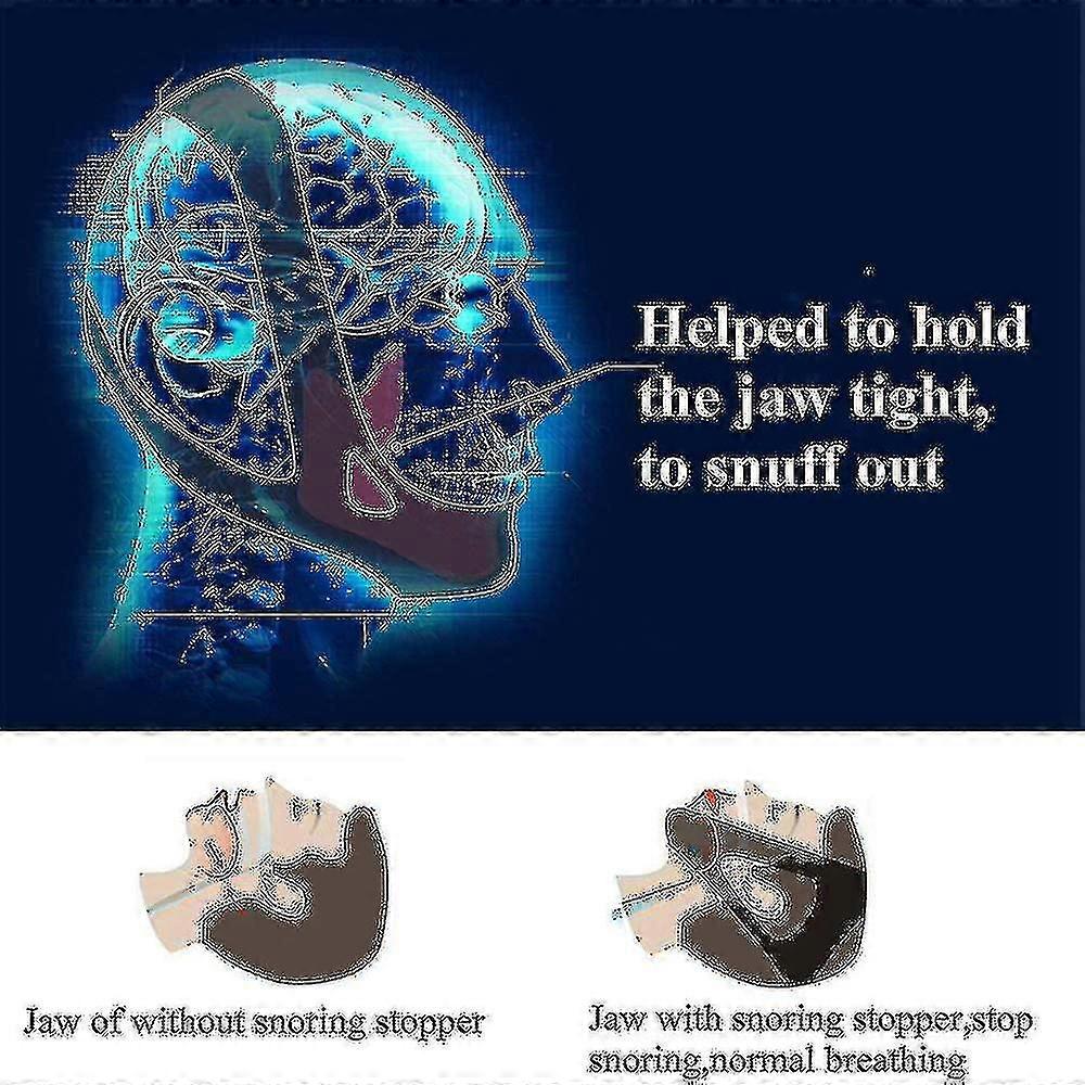 Anti-snoring Band Anti-snoring Cpap Adjustable Chin Band Sleep Apnea ...