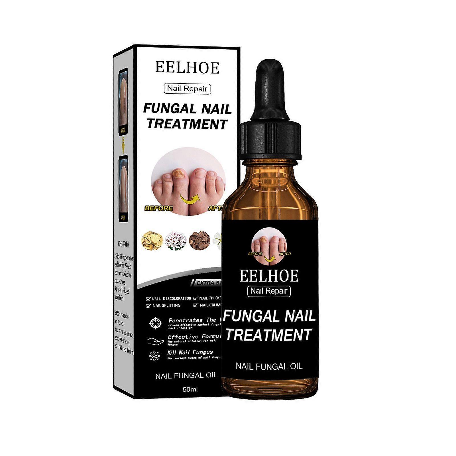 Nail Repair Solution Thickening And Brightening Nails Removing Gray ...