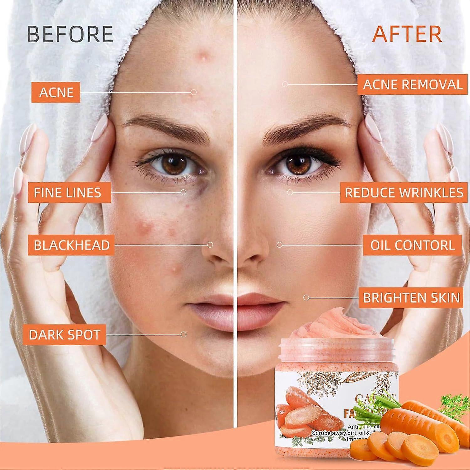 Face Scrub with Vitamin C and Carrot, Gentle Facial Exfoliating Scrub ...