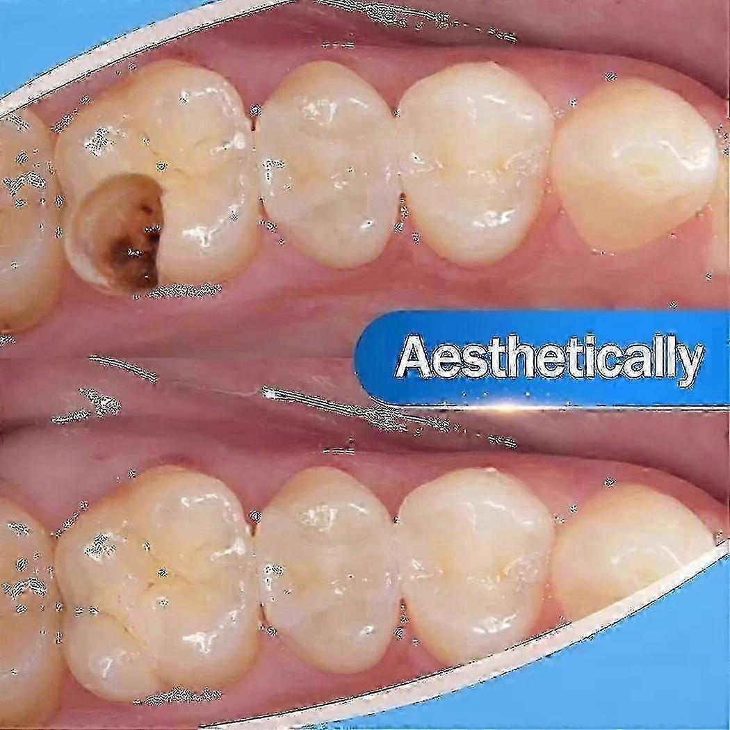 Teeth Resin Tooth Repair Dental Cement Light Curing Tooth Filling Cement for Cavity Repair ...