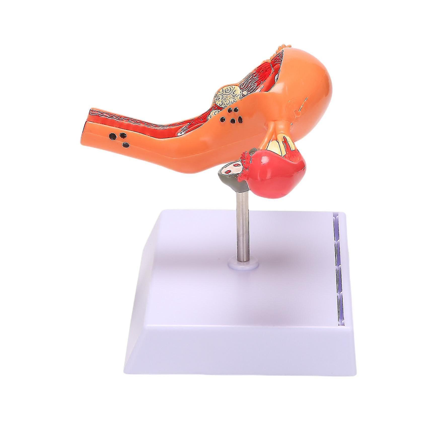 Uterus Model Ovary Model Anatomy Female Reproductive Organ Model A ...