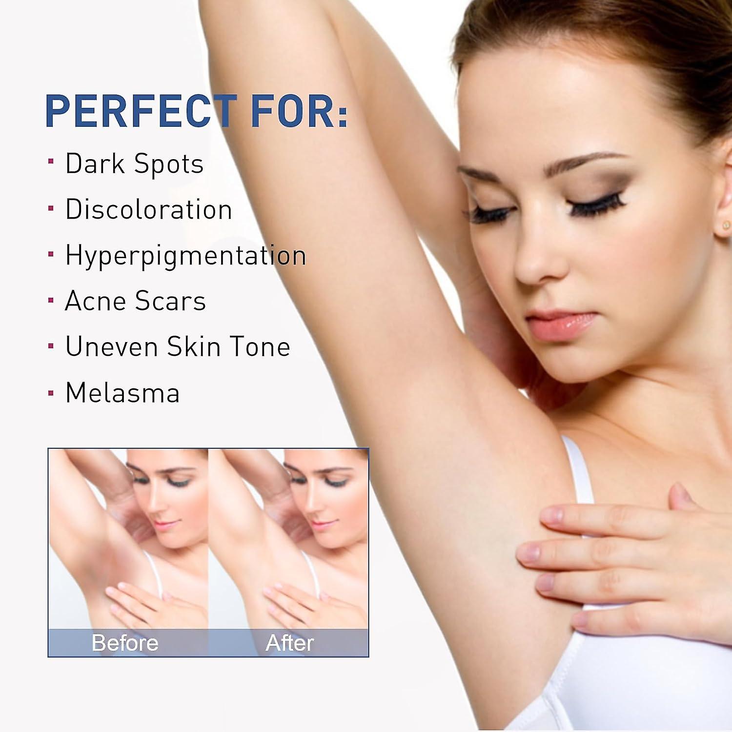 Underarm Deodorant Spray & Brightening Cream, Brightening Underarm ...