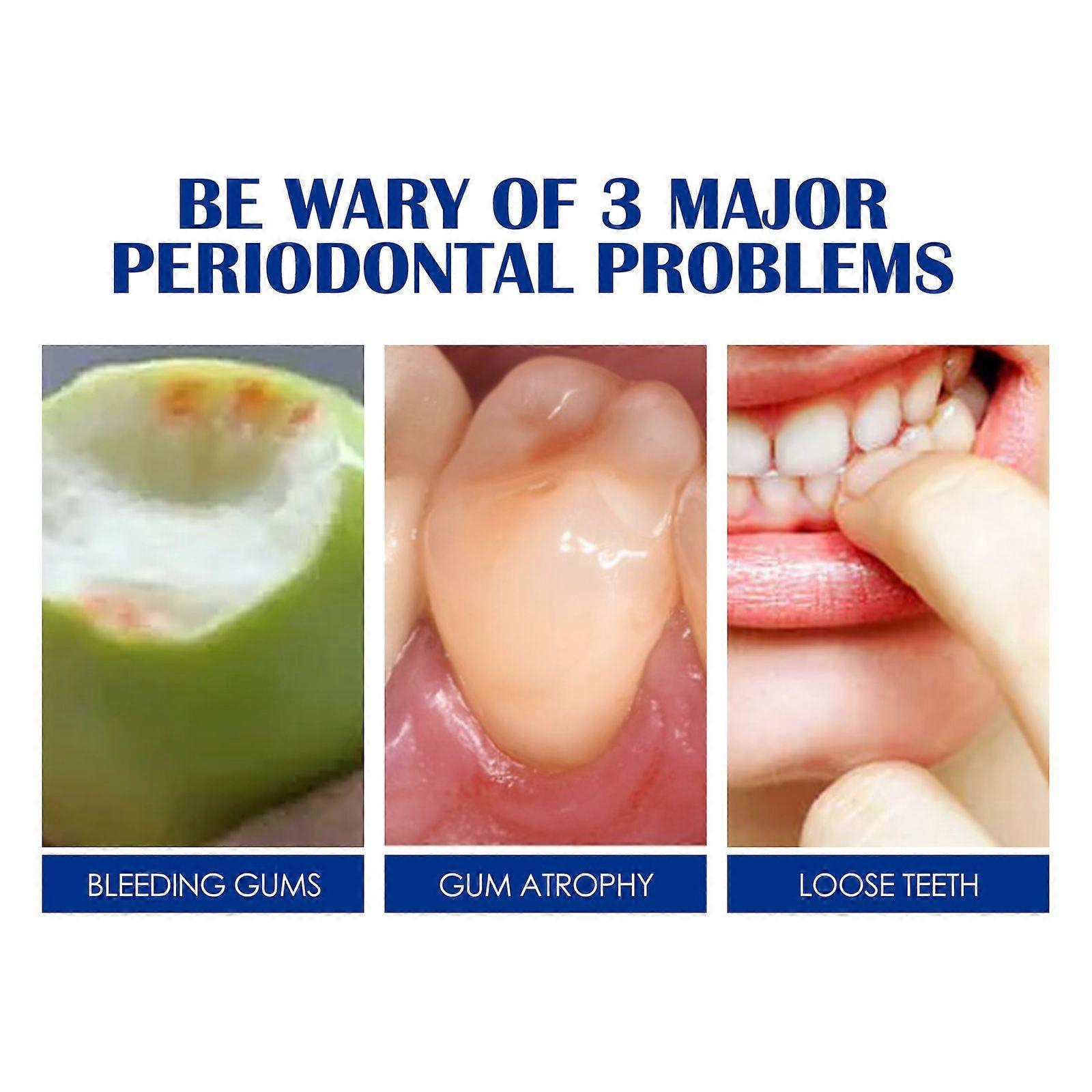 Repair Toothpaste, White Teeth Clean Stains And Tartar Yellow Mouth ...