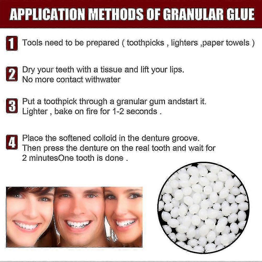 Repair Cement Teeth Gap Falseteeth Solid Glue Set Tooth Filling Kit ...