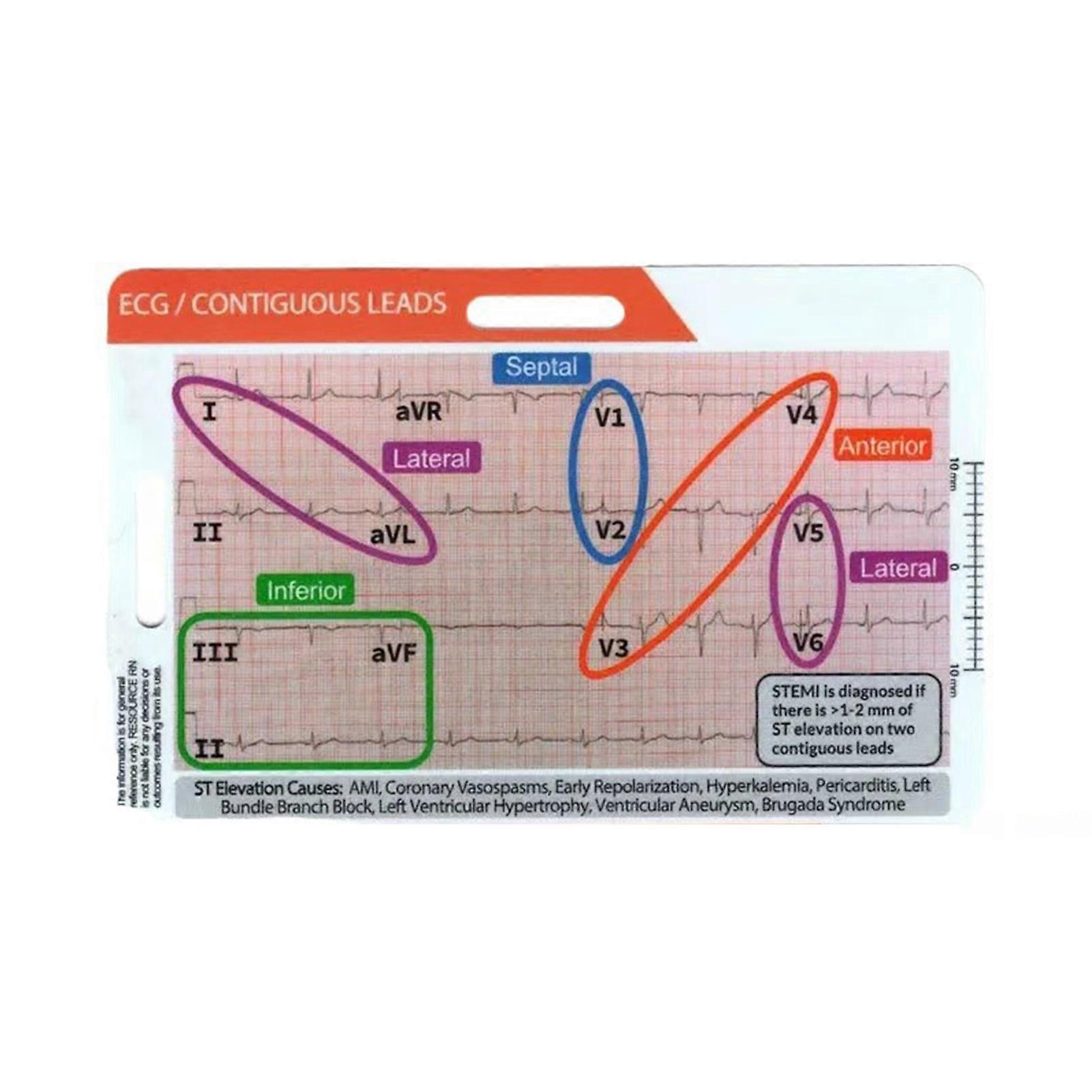 ECG/EKG Rhythm Pocket Card, Double Sided Design EKG Rhythm Interpretation Badge Card ECG Rate ...