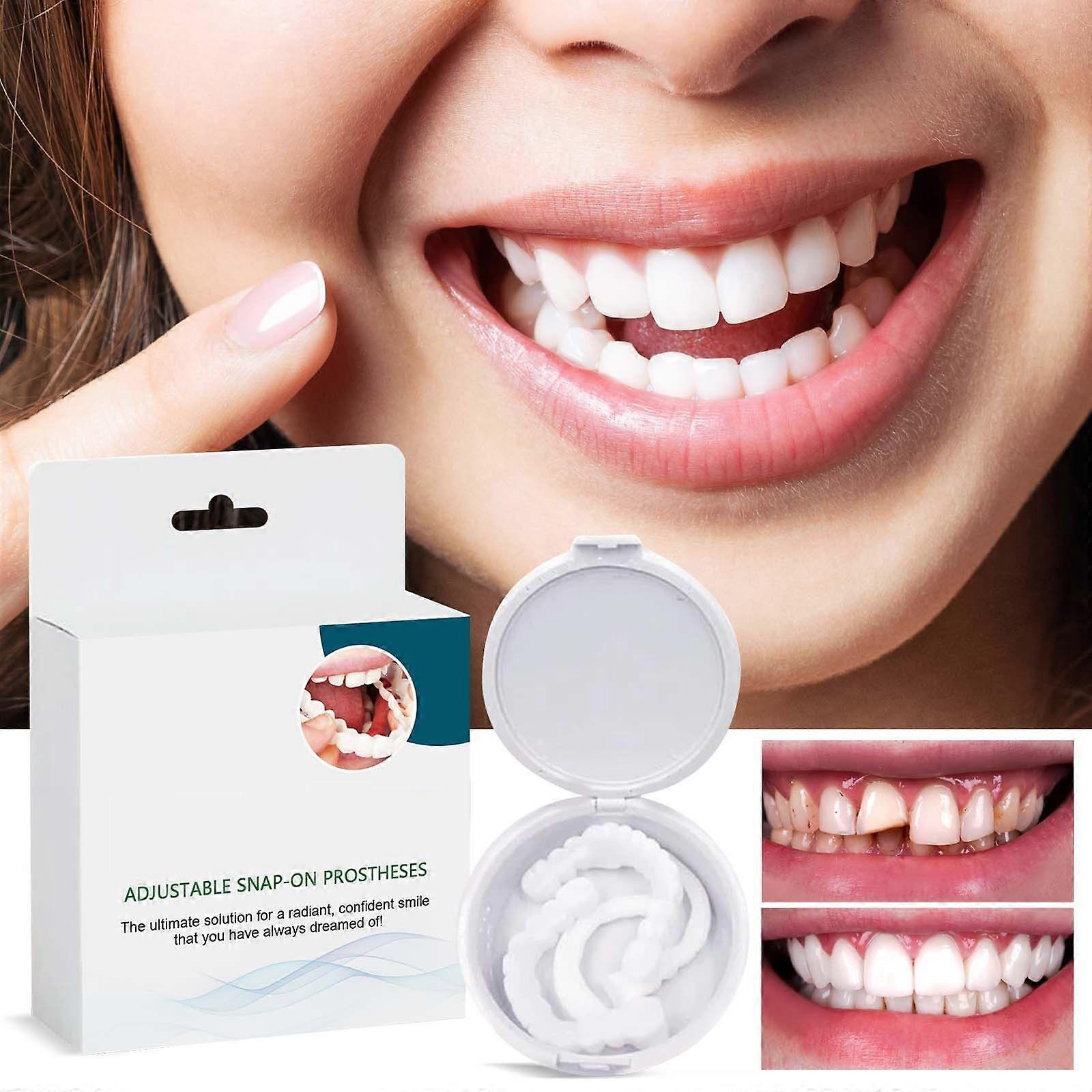 Denture Teeth Temporary Fake Teeth for Snap on Instant & Confidence ...