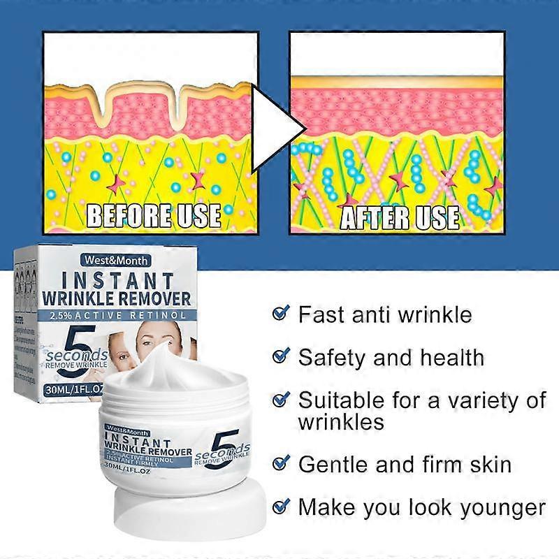 Retinol Anti Wrinkle Cream 5 Seconds Instant Wrinkles Removal Cream ...