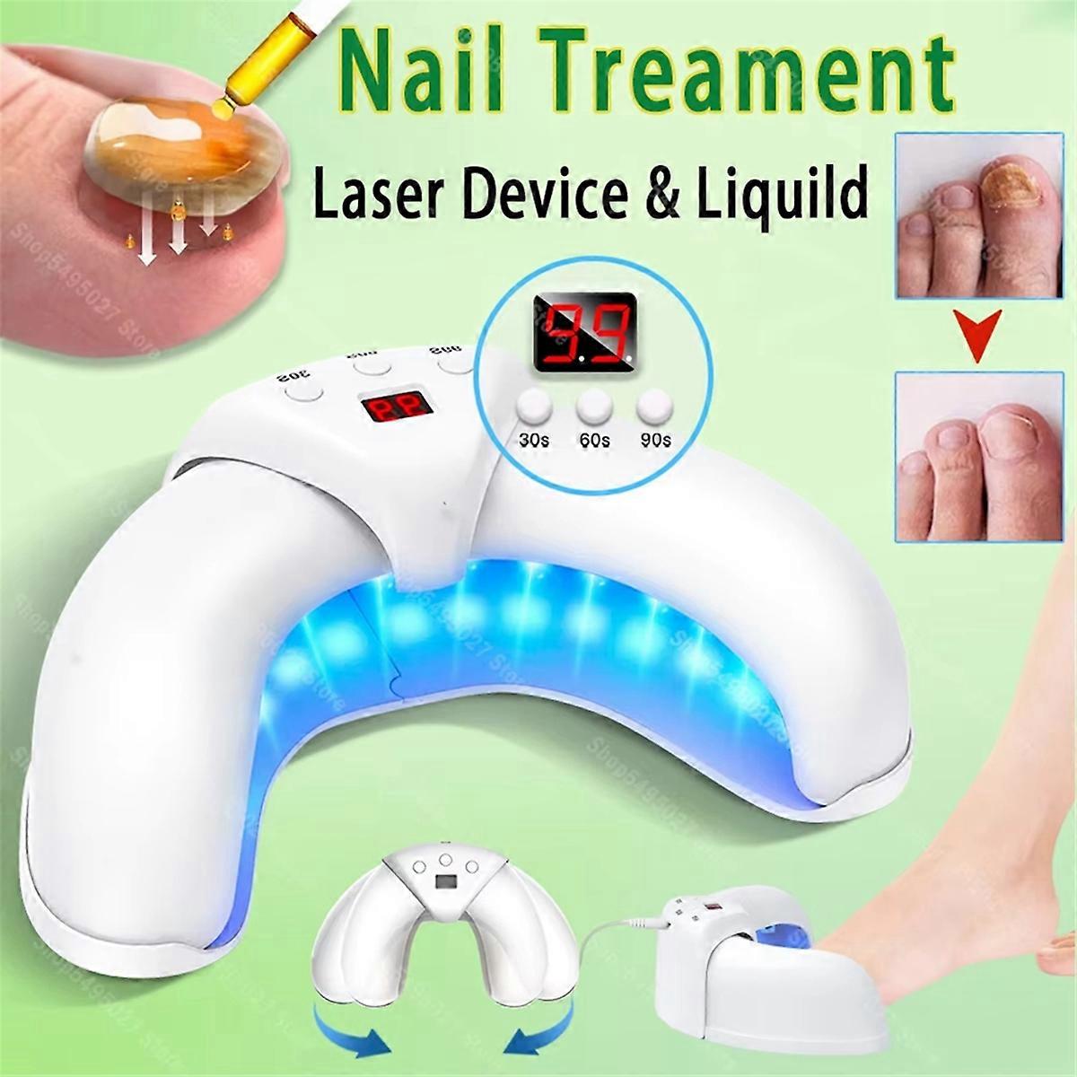 Nail Laser Treatment Device Remove Onychomycosis Grow Toe Nail | Fruugo UK