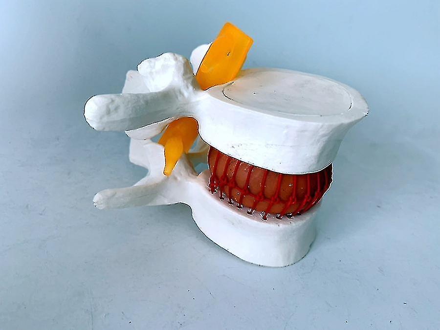 Human Spine Model Vertebrae Lumbar Intervertebral Disc Model Vertebral ...