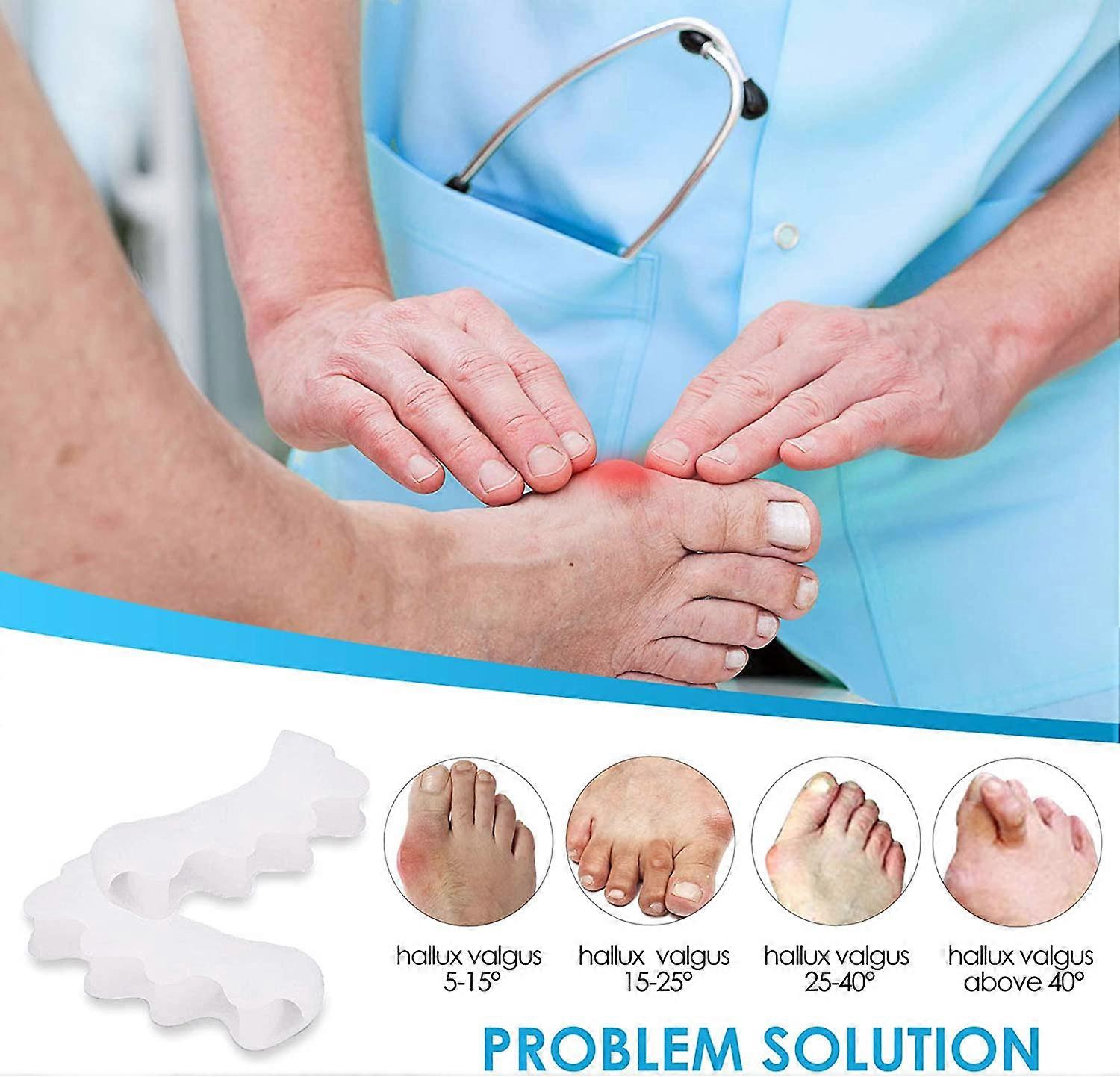 Toe Separators for Overlapping Toes, Gel Toe Straightener Bunion ...