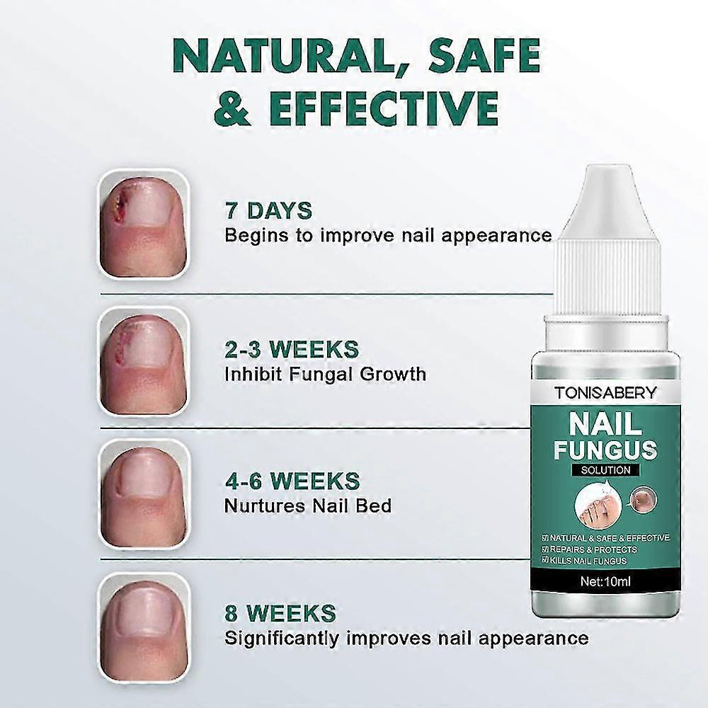 Nail Fungus Treatment Foot Care Essence Anti Infection Paronychia ...
