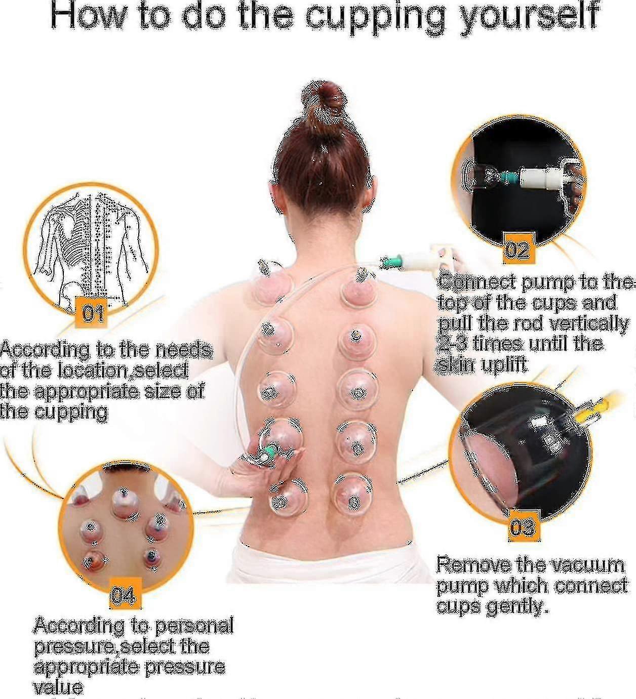 Cupping Therapy Sets,24 Cups Cupping Set With Pump Vacuum Suction Cups ...