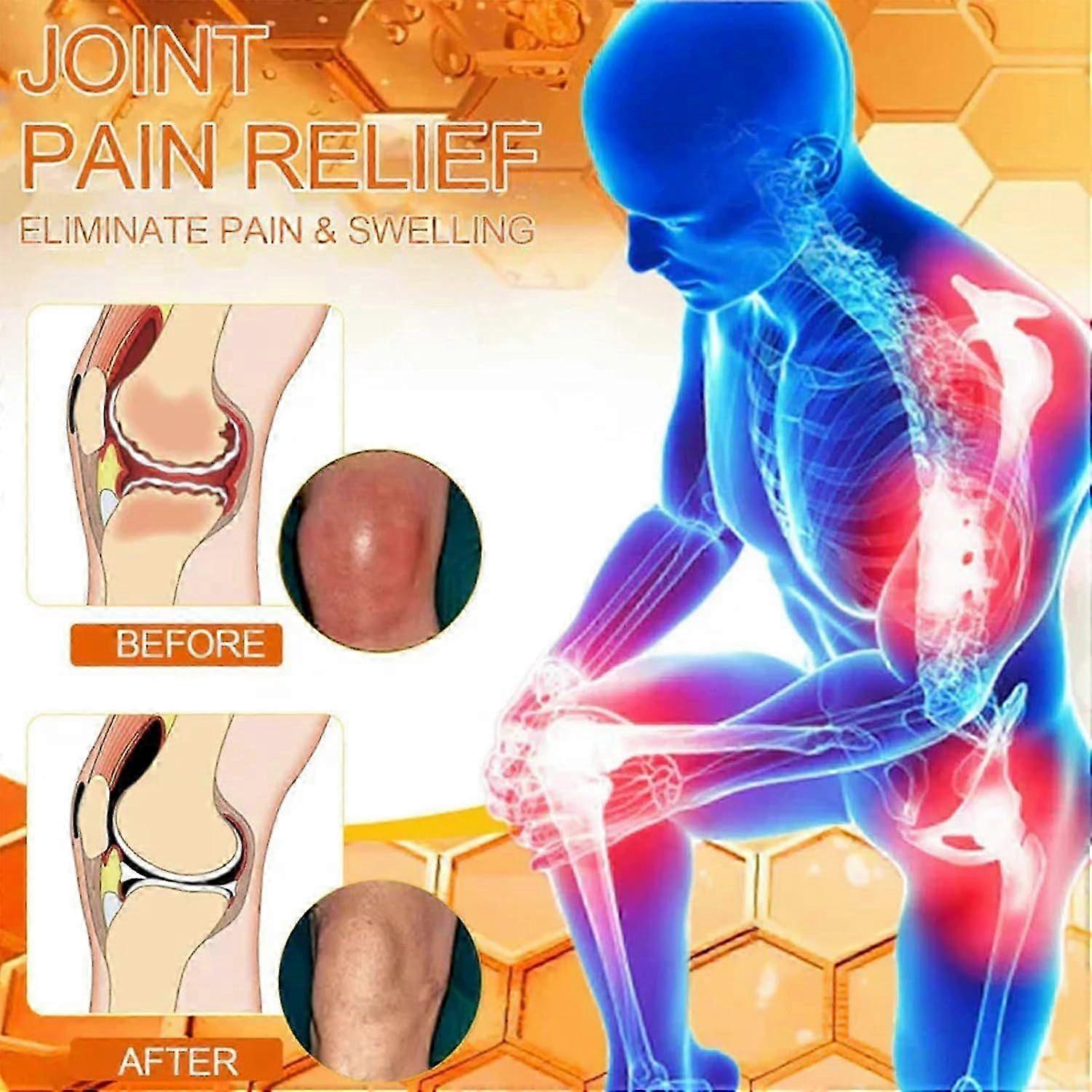 Bee Venom Spray, Bee Venom Joint & Bone Care Spray, Magnesium Oil Bee ...