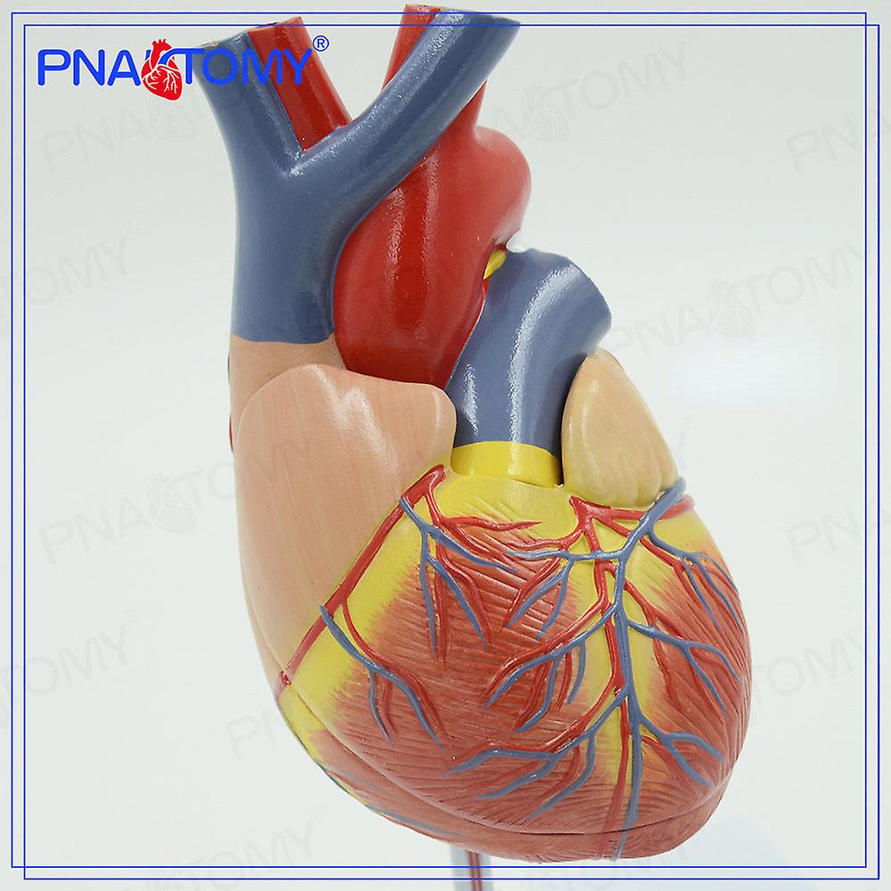 Kx-a401 Heart Model 4-stage Vascular Artery Pathological Stage Cardiac ...