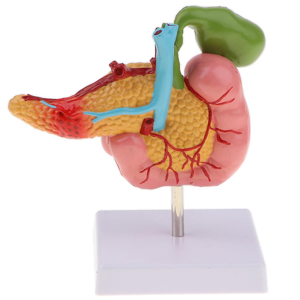 1:1 Life Size Anatomical Human Pancreas Duodenum Gallbladder Pathology ...