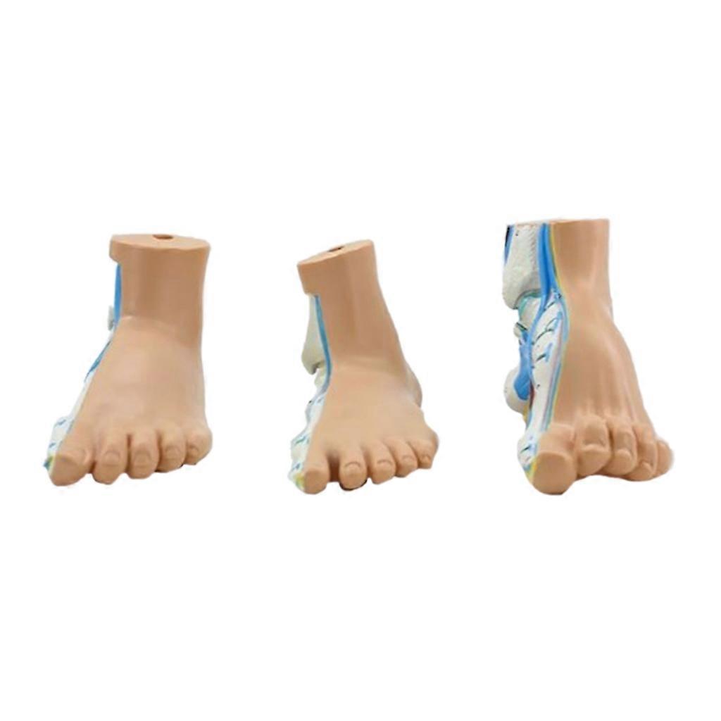 Normal/Flat/High Arched Foot Anatomy Model, Anatomical Human Foot Ankle ...