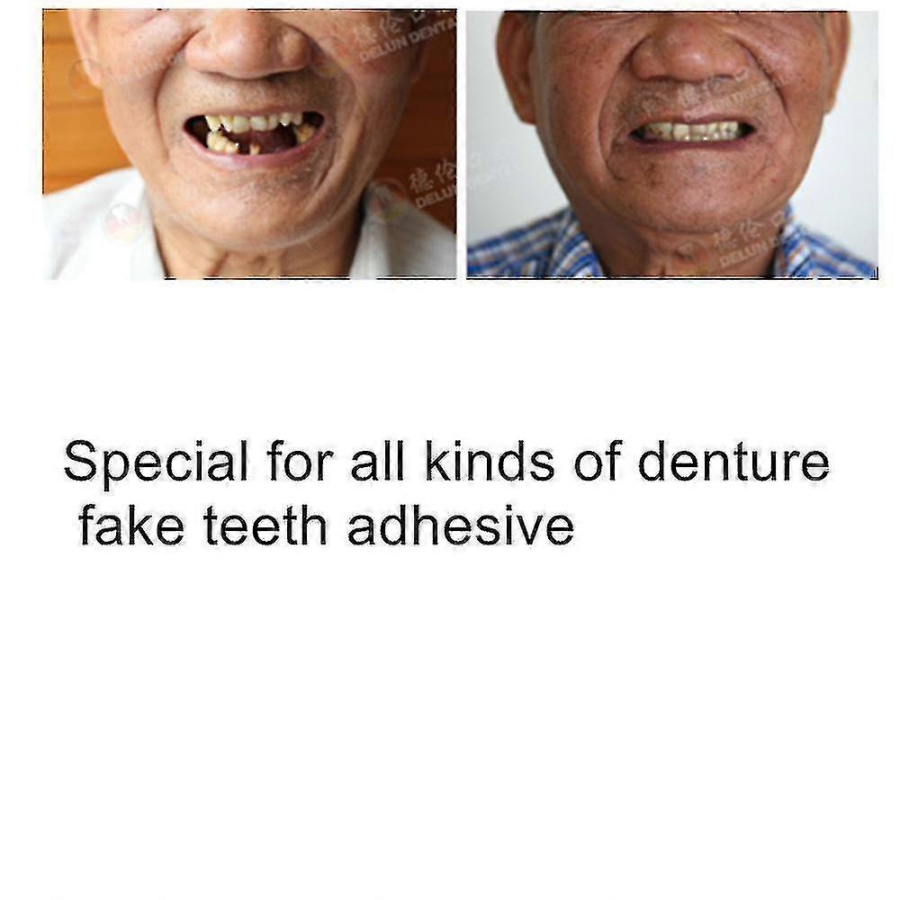 Dental Denture Oral False Fake Teeth Smile Veneers Paste Braces ...