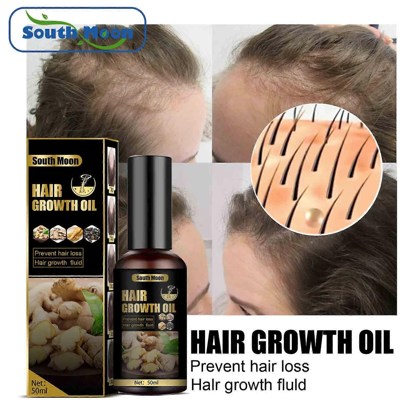 Ginger And Polygonum Multiflorum Growth Spray Sprayed Hair Spray To ...