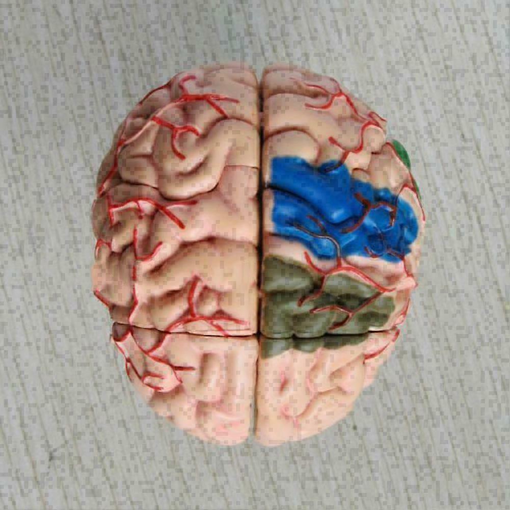 4D Disassembled Anatomical Human Brain Model Anatomy Teaching L9U4 Tool ...