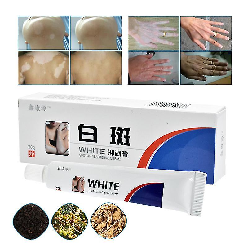 20g Chinese Medical White Spot Disease Cream Pigment Melanin Promoting ...