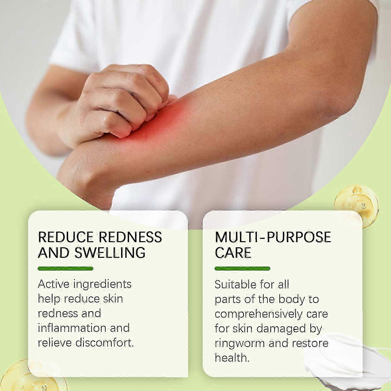 Ungüento herbal para el eczema, Crema para el eczema, Crema herbal para ...