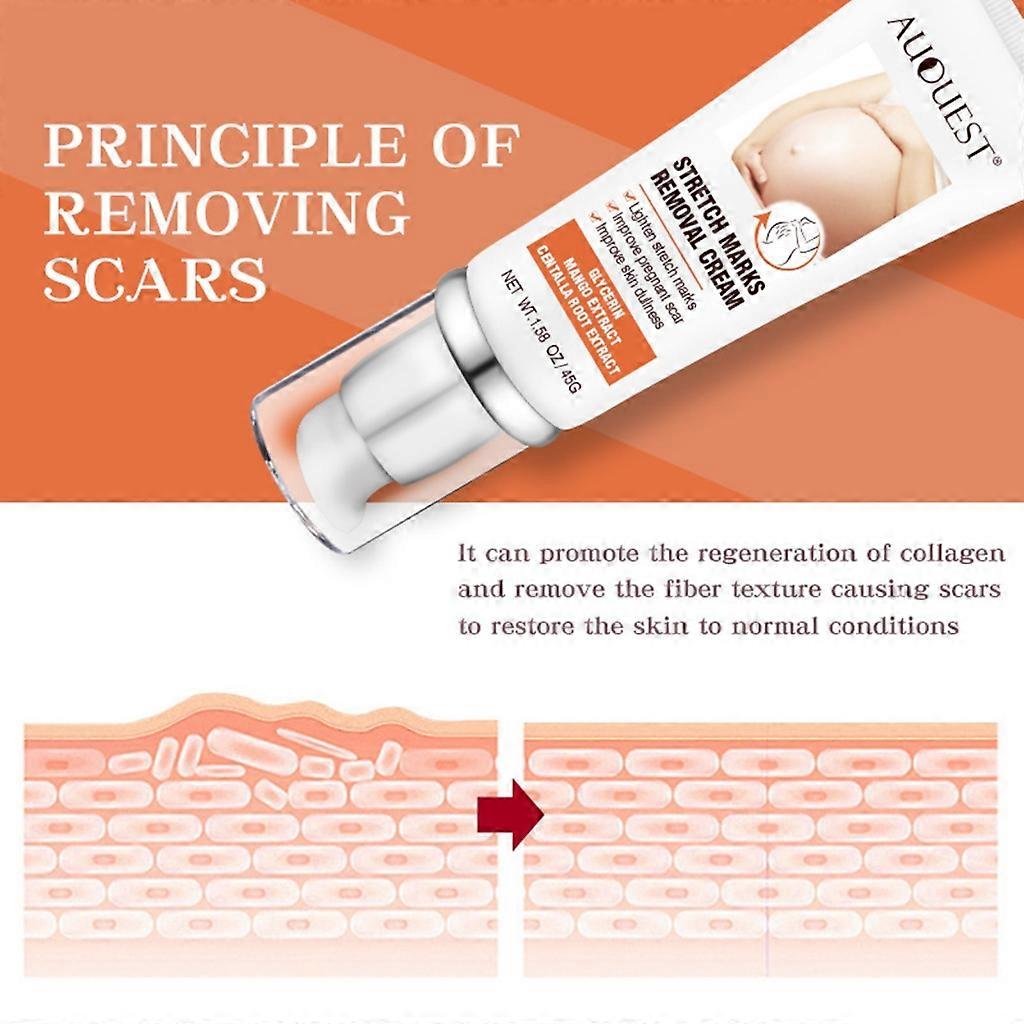 Stretch Mark Remover Cream Skin Care Remove Acne Burn Pregnancy Women ...
