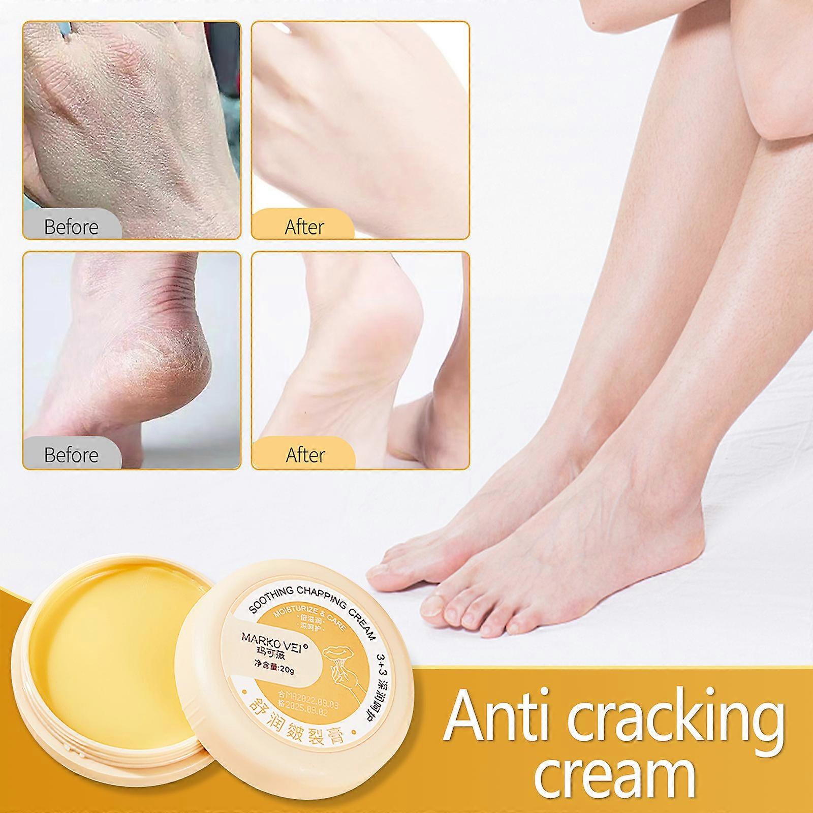 Cracking Cream Chapping Cream Hand And Foot Care Antifreeze Foot ...
