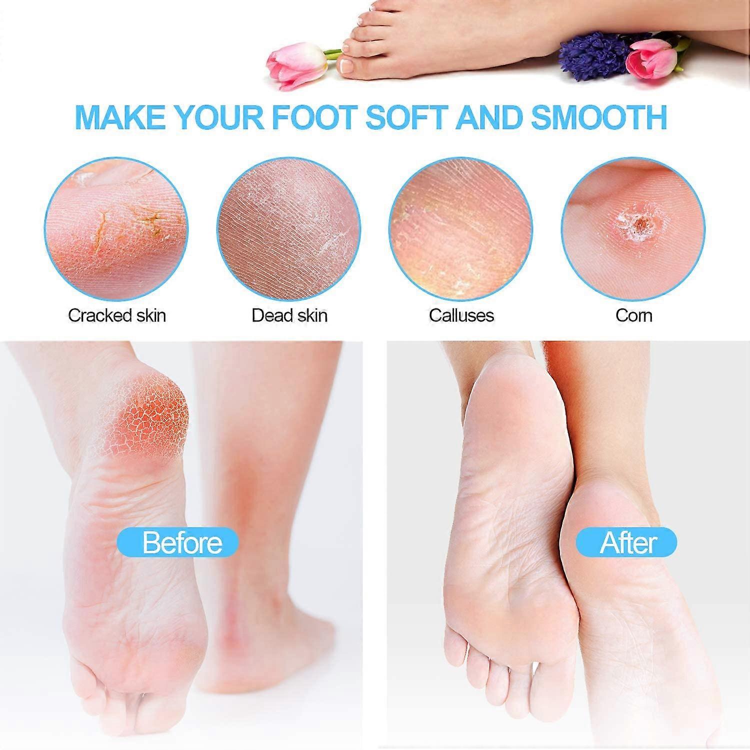 Professional Manicure Foot Cleansing Tool Set Callus Foot Exfoliator ...