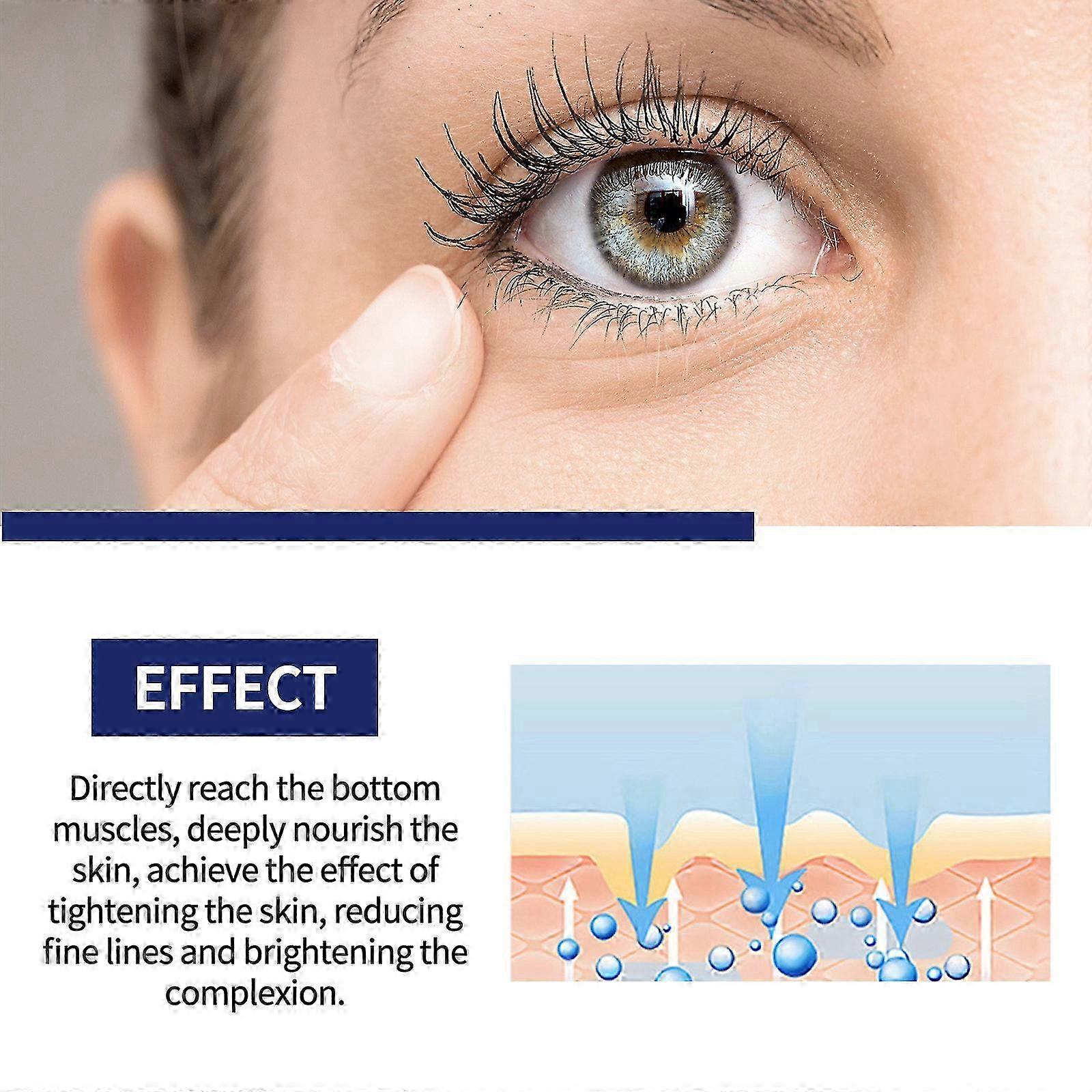 Jaysuing Firming Eye Gel, Fading Spots And Fine Lines, Anti-Aging, Even ...