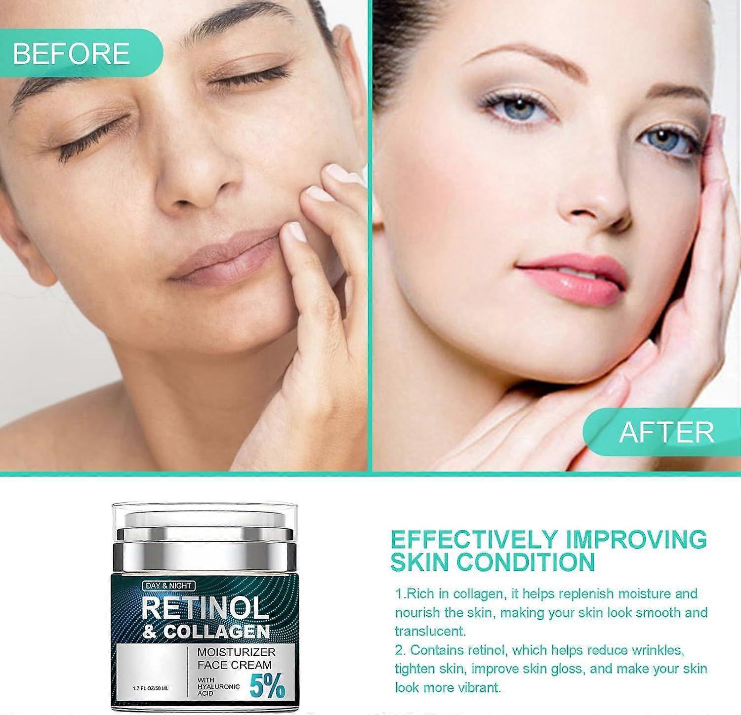 Retinol Collagen Cream for Face, Retinol Facial Moisturizer, Intensive ...