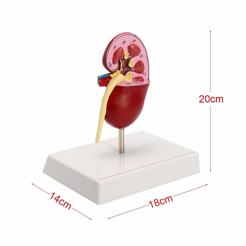 Kidney Pathology Model Human Anatomy Pathological Kidney Model For ...