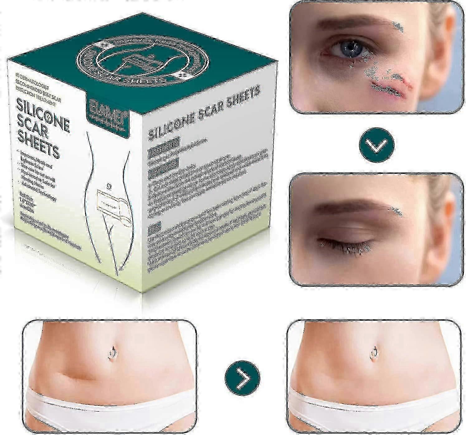 Silicone Plasters For Scars, Silicone Scar Films For Surgeries ...