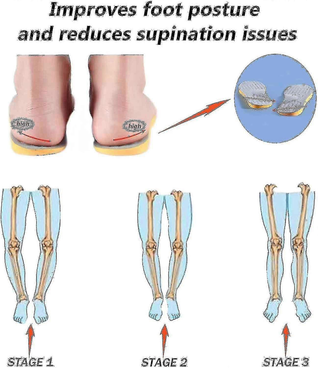Supination Insoles For Over Supination High Arch Support,orthotic ...