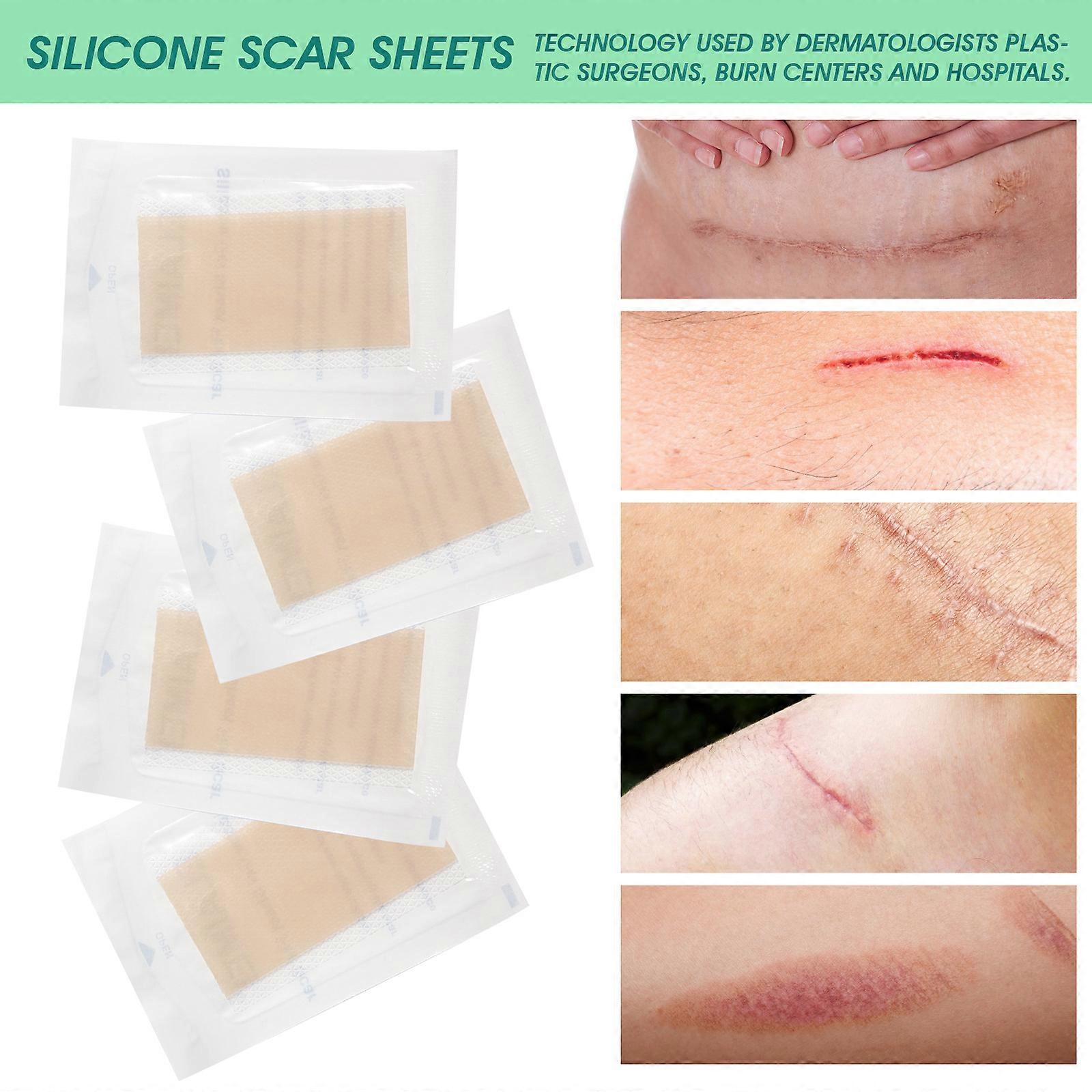 Clear dressing to help make scars flatter, softer and lighter, adhesive ...