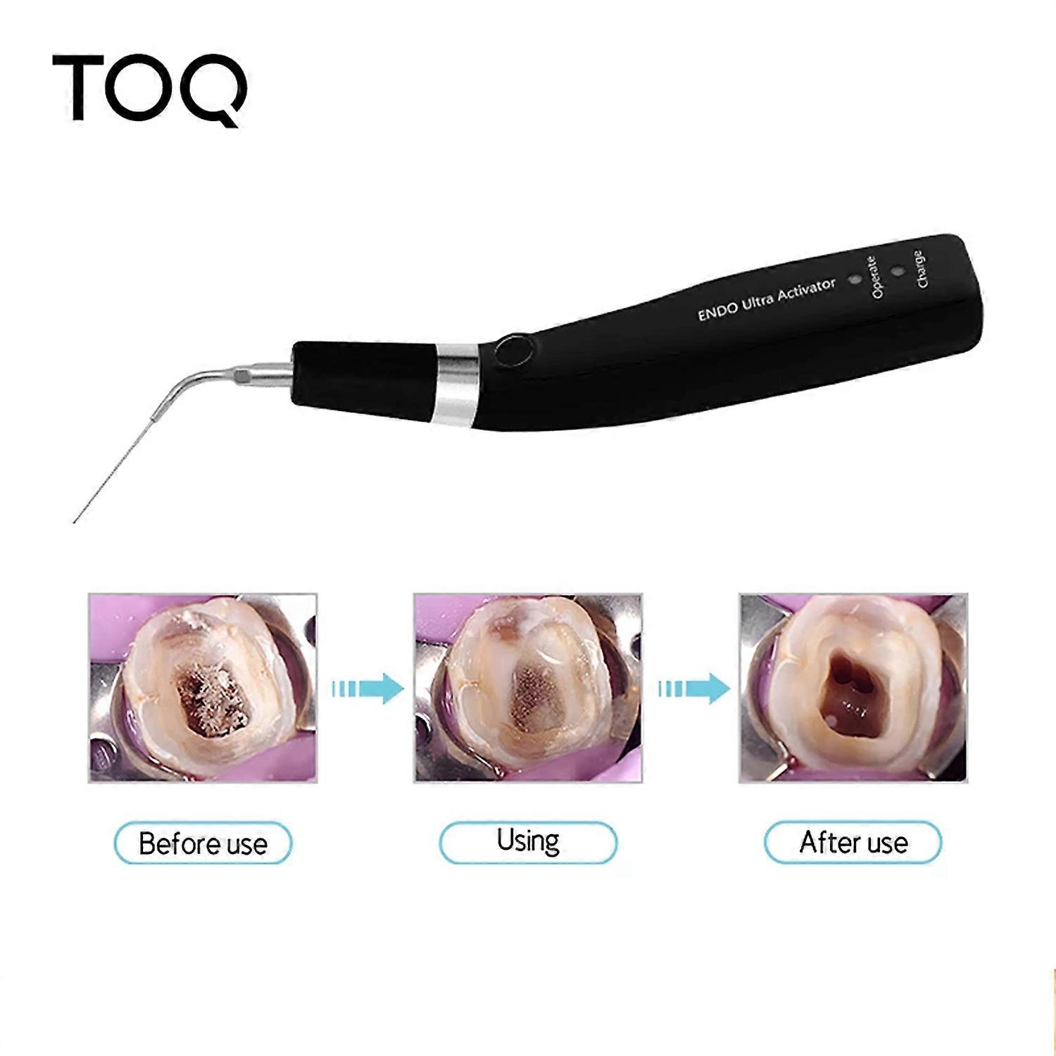 Dental Endo Ultra Activator Endo Irrigator Cordless Ultrasonic ...