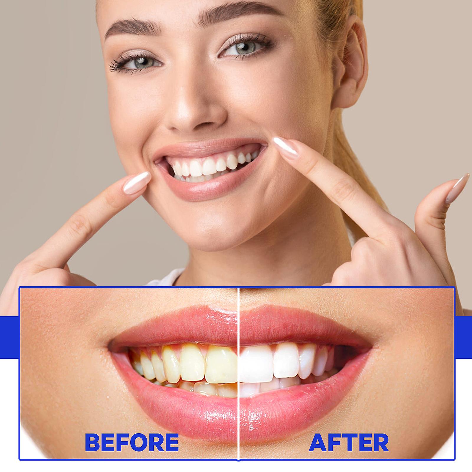 Stain Removal Whitening Toothpaste Fight Bleeding Gums Toothpaste 200ml ...
