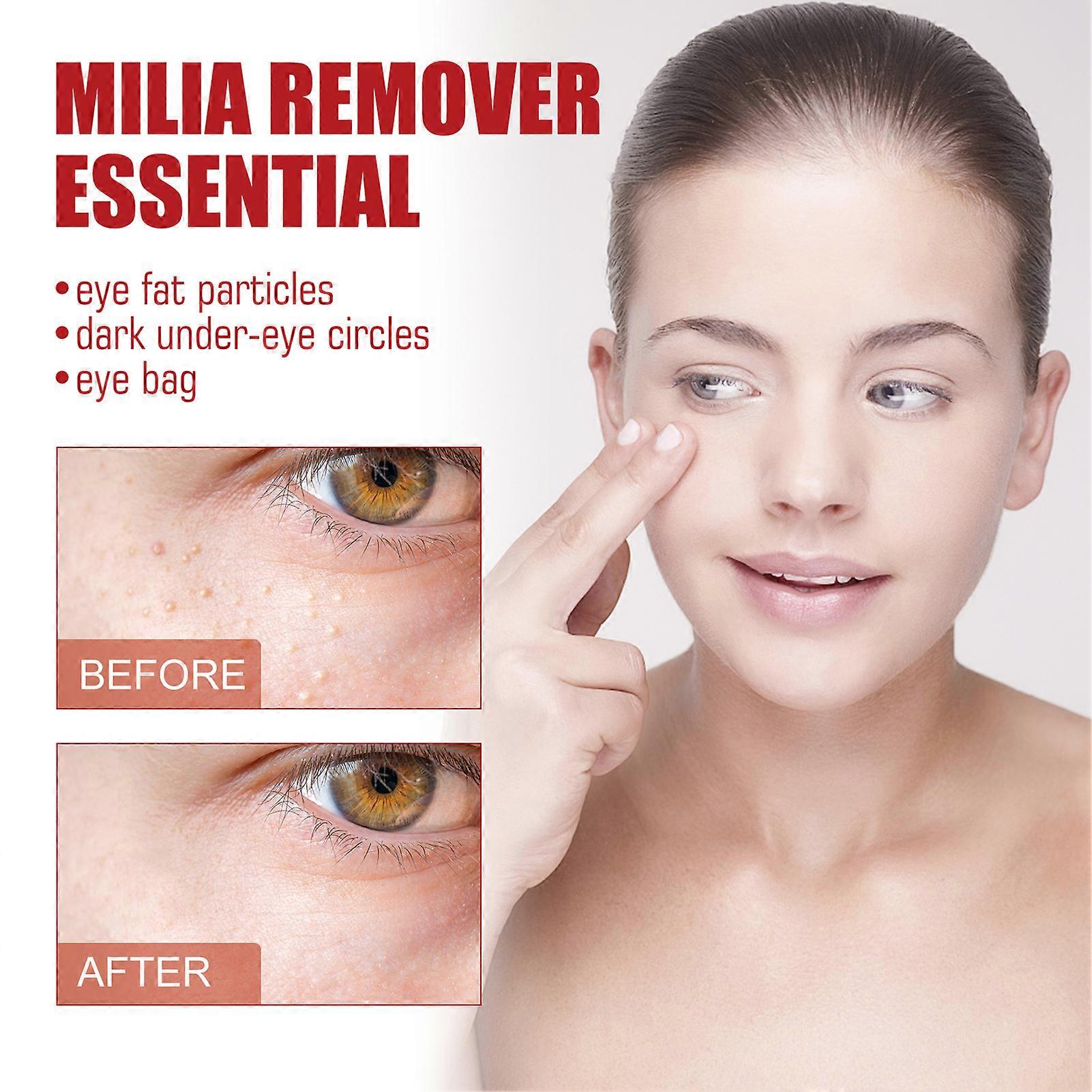 30ml Milia Removing Eye Essence Moisturizing Eye Cream Natural ...