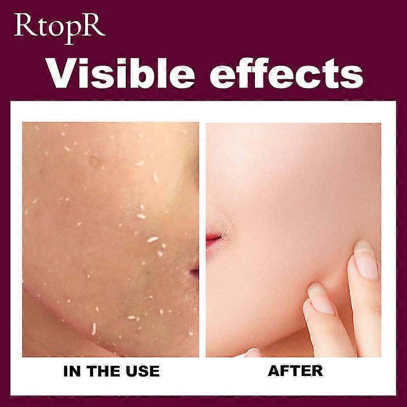 Facial Exfoliating Gel Cream Whitening Moisturizing Facial Scrub Clear ...