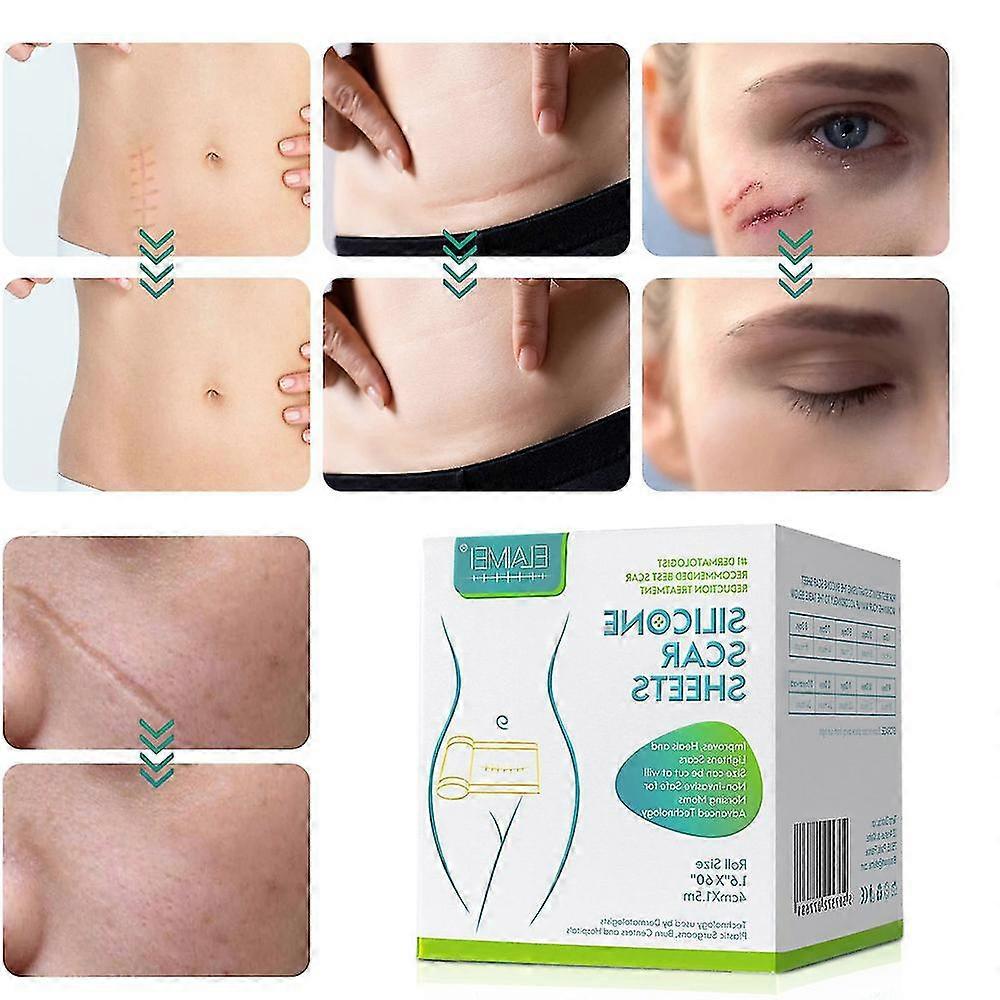 Medical Soft Silicone Tape For Scar Removal, Tear Off Silicone Tape ...