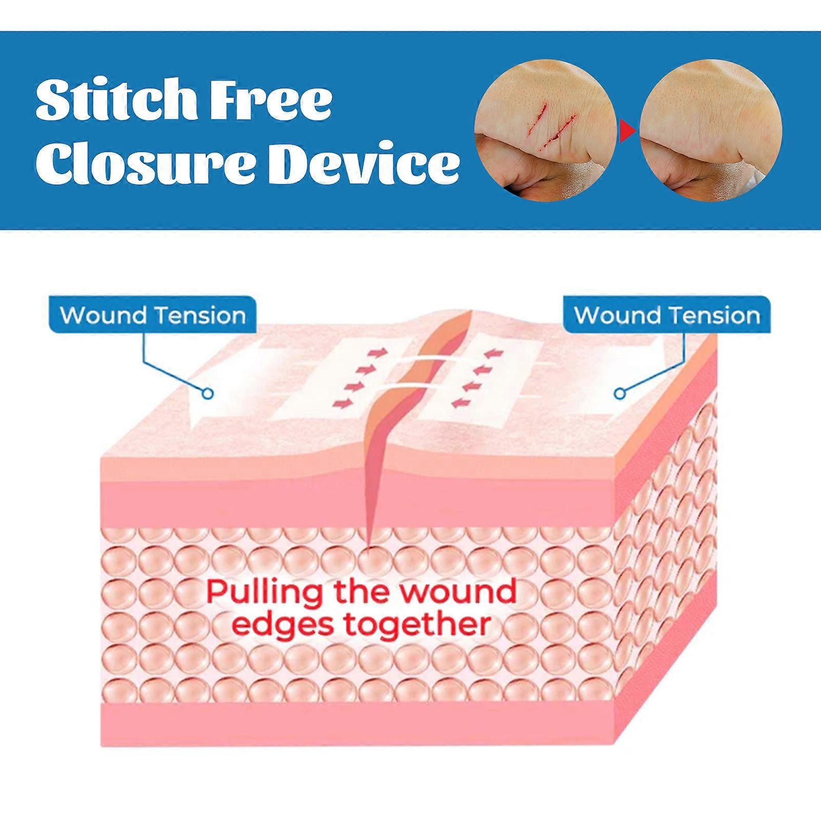 Wound Closure Strips, Emergency Wound Closure Device, Butterfly ...
