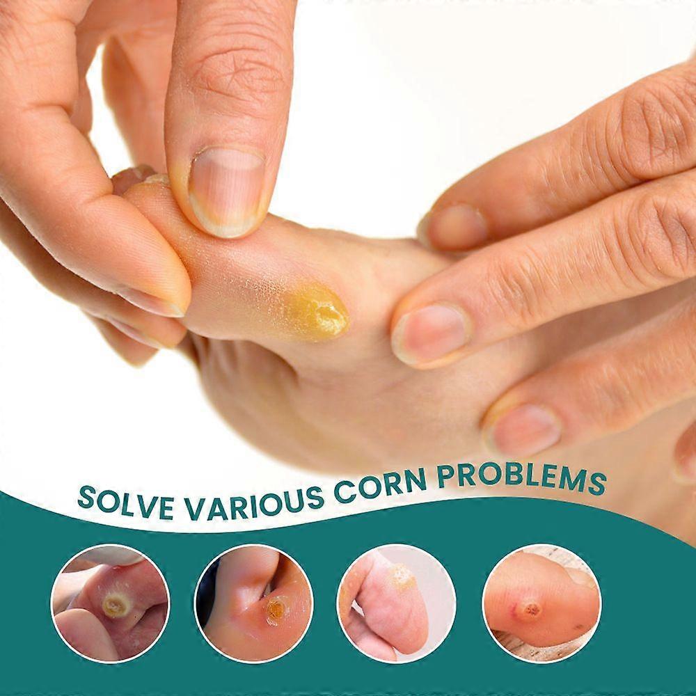 Sumifun Trade Boxed Corn Patch Hard Cocoon Removal Calluses Wart Dead ...