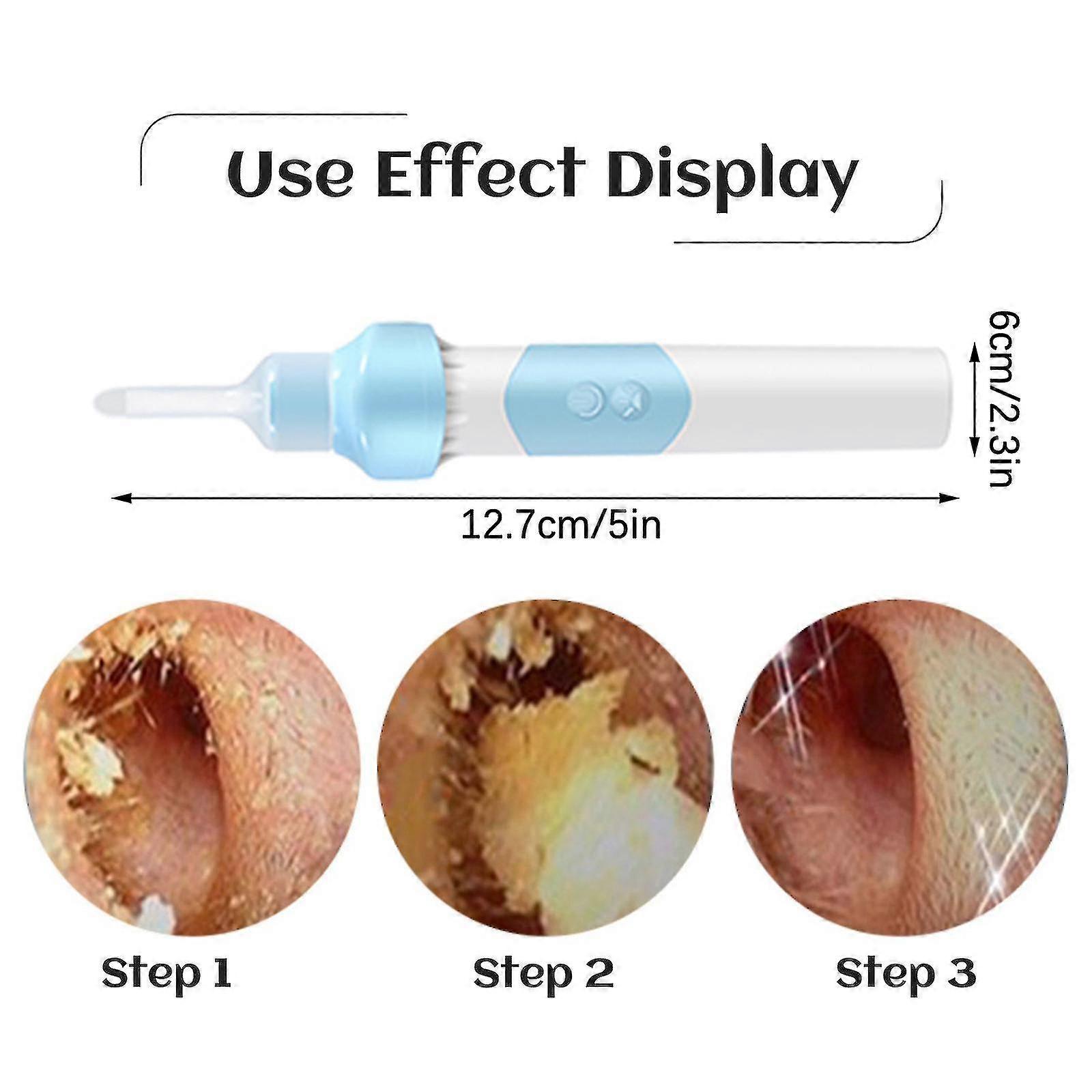 Electric Ear Suction Ear Cleaner For Adults Teens | Fruugo UK