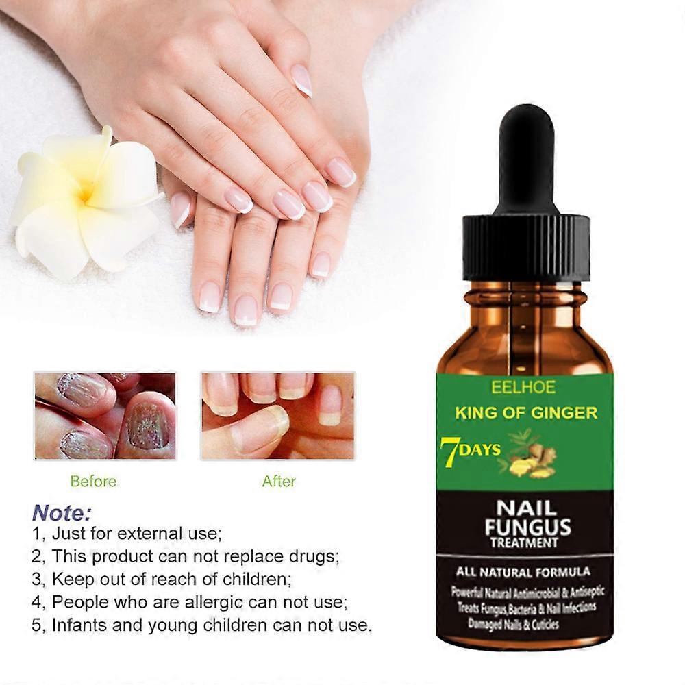 1/2/3PCS 7days Nail Treatment, Ginger Nail Treatment, Multi-purpose ...