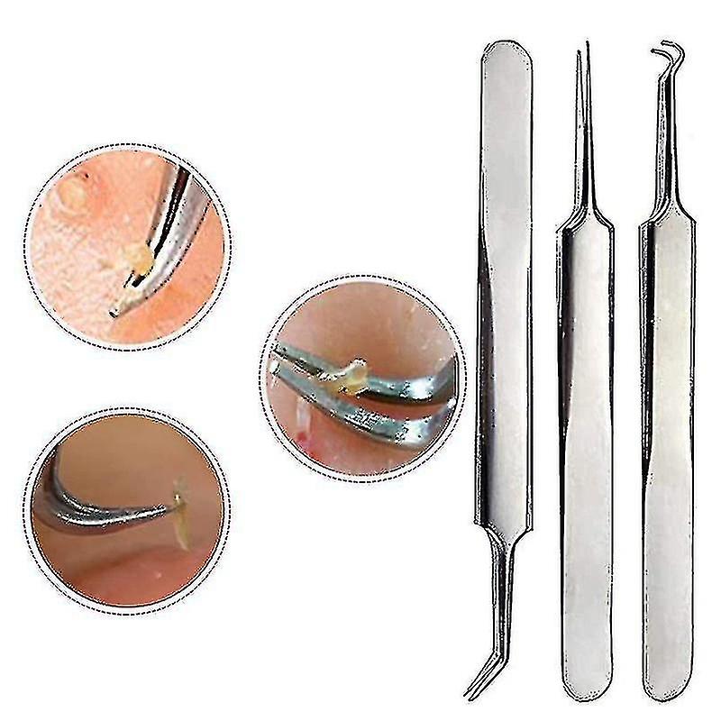Pimple Popper Tool Kit,10 Pcs Professional Pimple Comedone Extractor ...