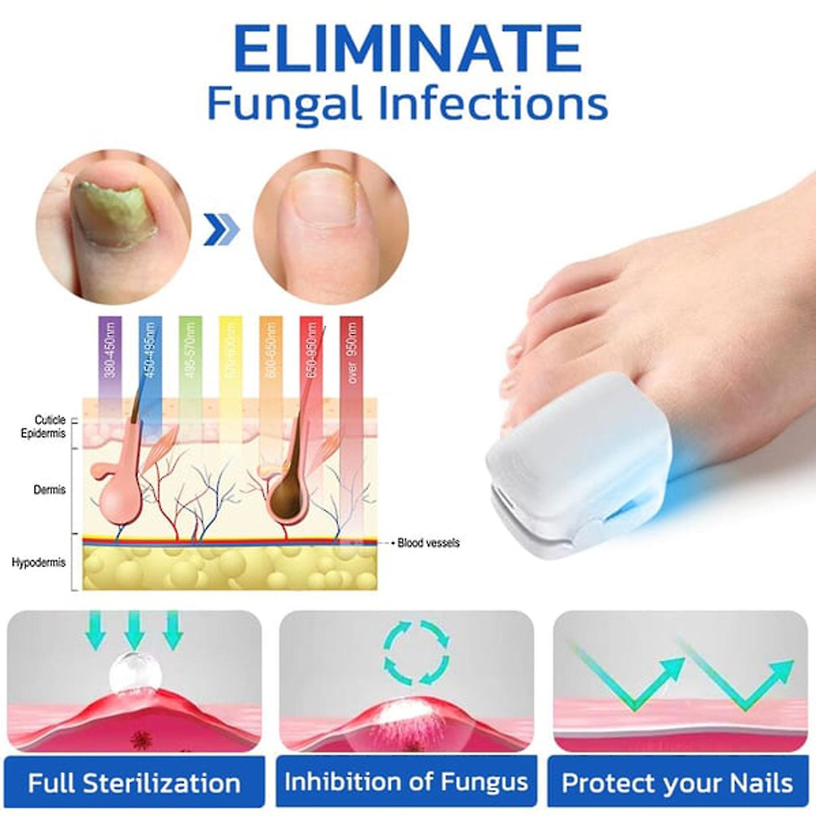 Nail Fungus Laser Treatment Device Fingernail Toes Infections Cleaning ...